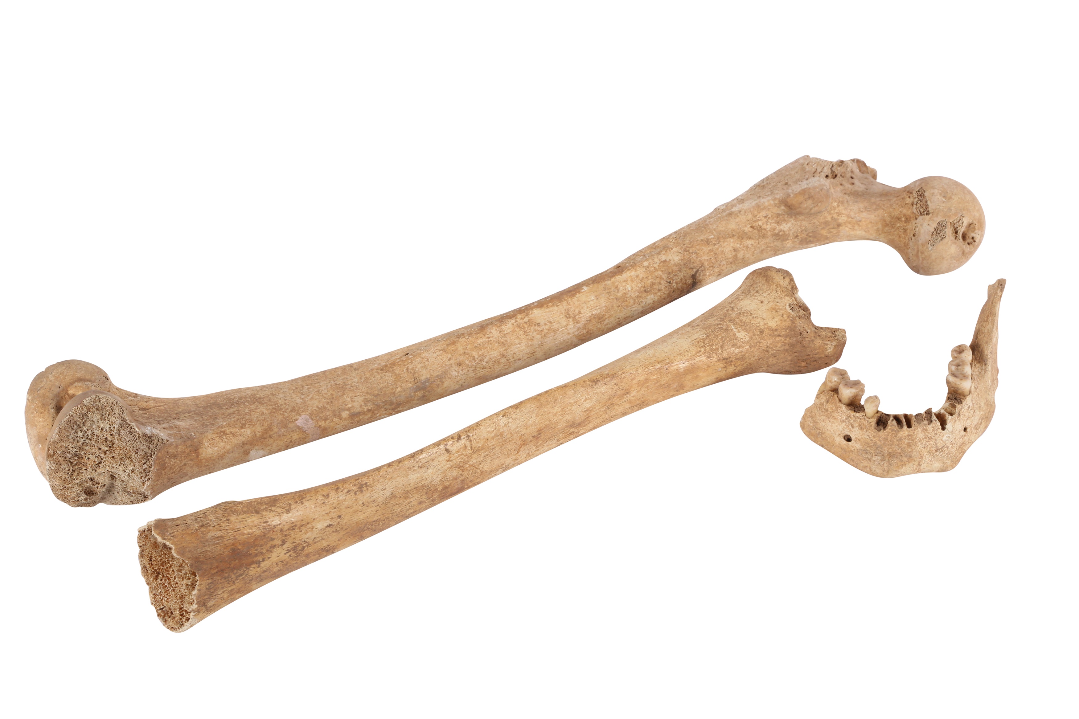 Lot 39 - ARCHEOLOGY /OSTEOLOGY: ROMAN HUMAN BONES